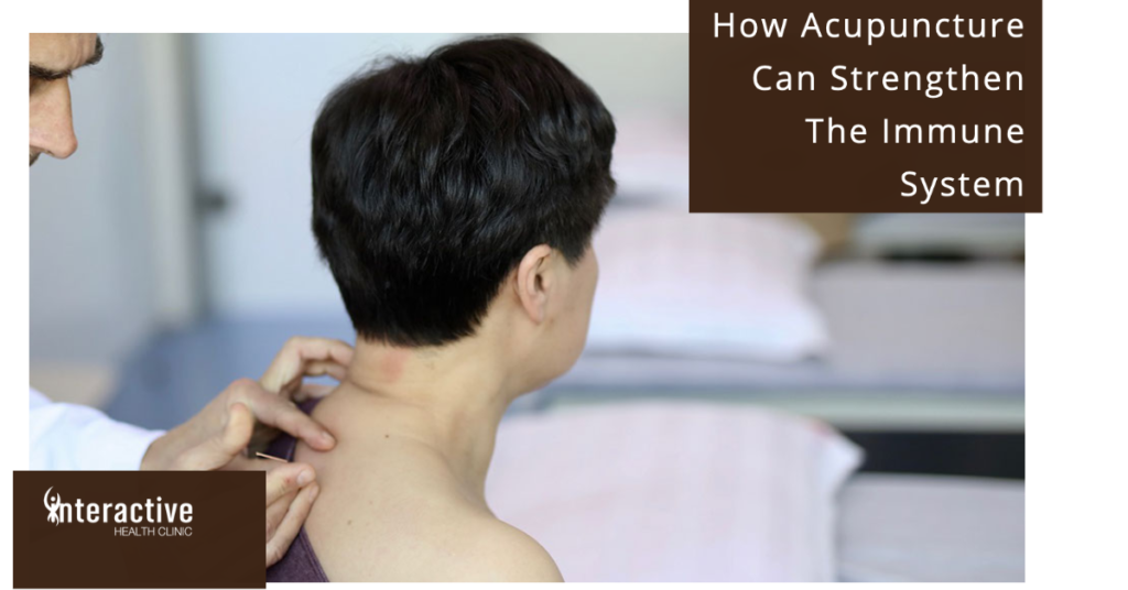 How Acupuncture Can Strengthen The Immune System