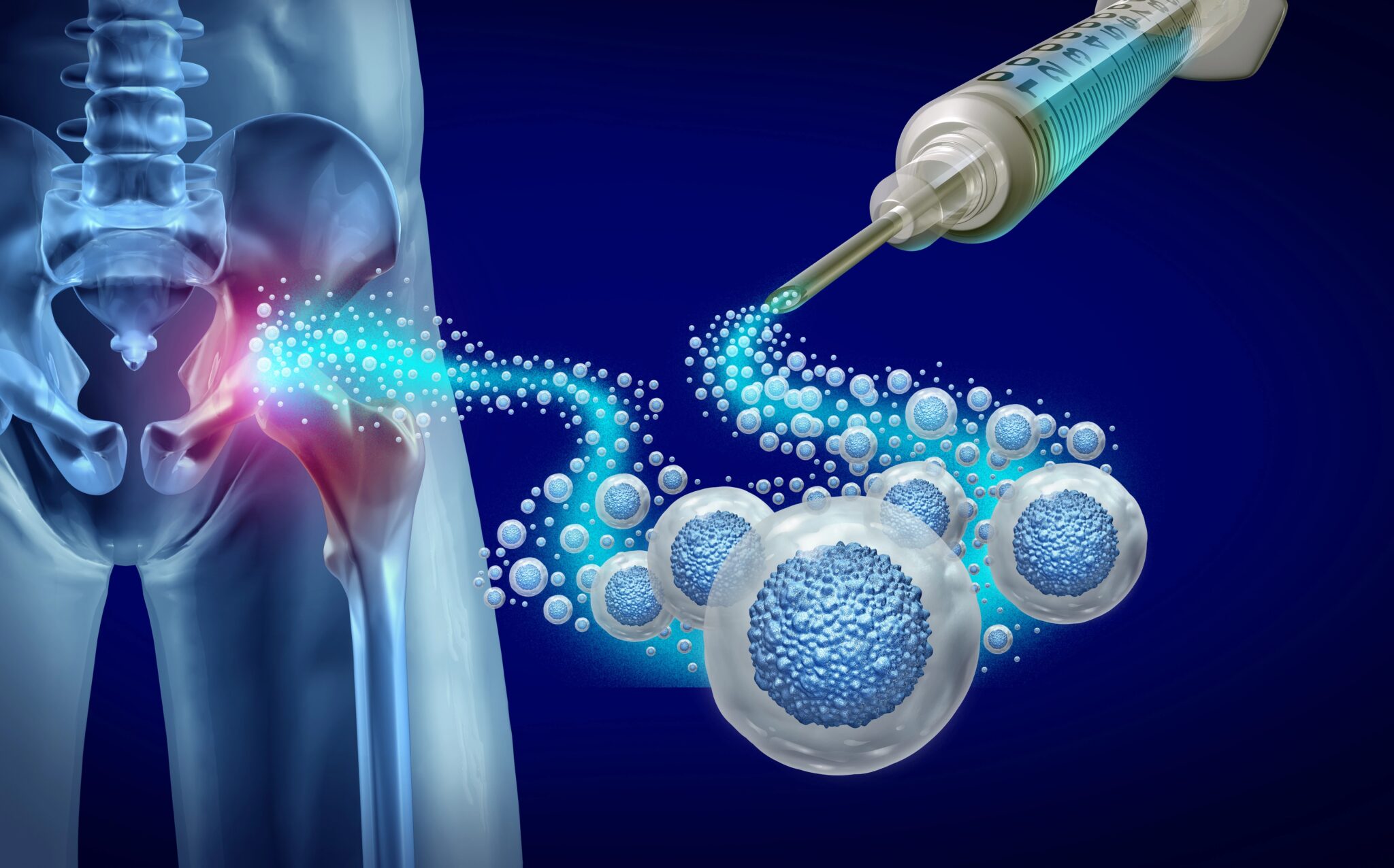 Regenerative Medicine vs. Surgery: What Lynnwood Patients Should Know ...